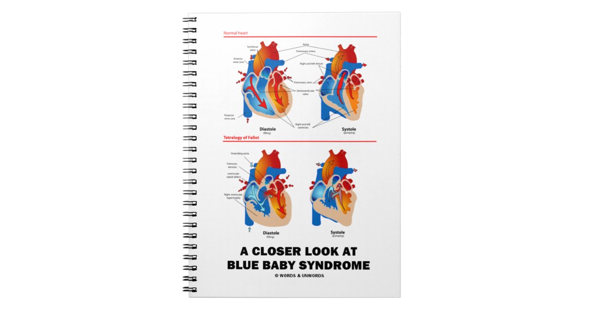 A Closer Look At Blue Baby Syndrome Heart Anatomy Notebook | Zazzle