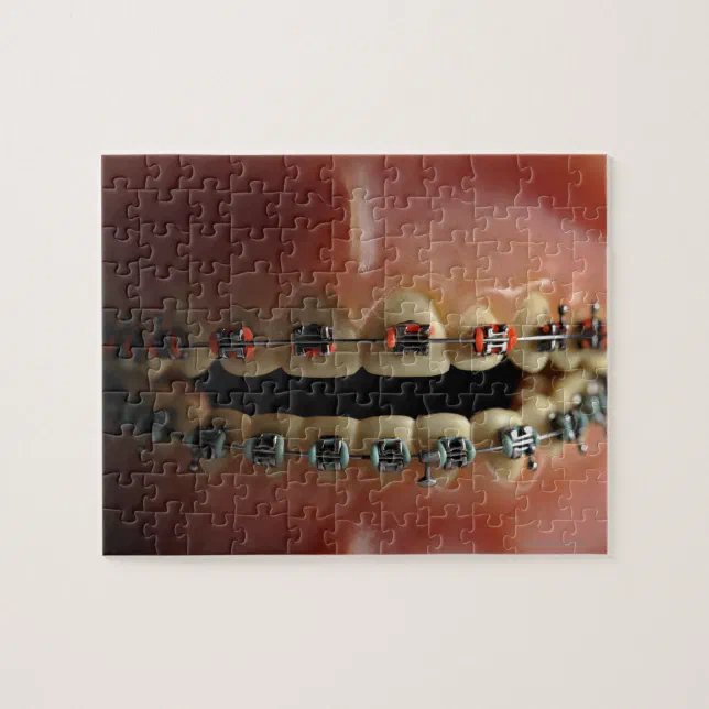 A dental model and Teeth braces Jigsaw Puzzle | Zazzle
