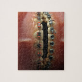 A dental model and Teeth braces Jigsaw Puzzle | Zazzle