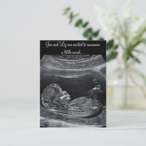 A Little Secret ~ Pregnancy Announcement | Zazzle