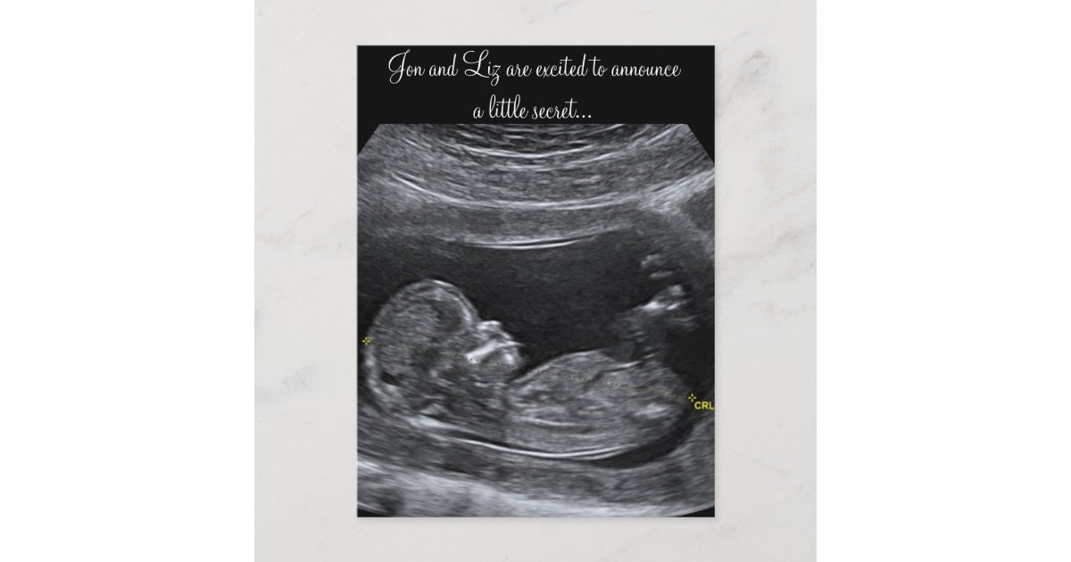 A Little Secret ~ Pregnancy Announcement | Zazzle