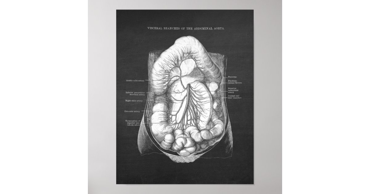 Abdominal Aorta Anatomy Poster | Zazzle