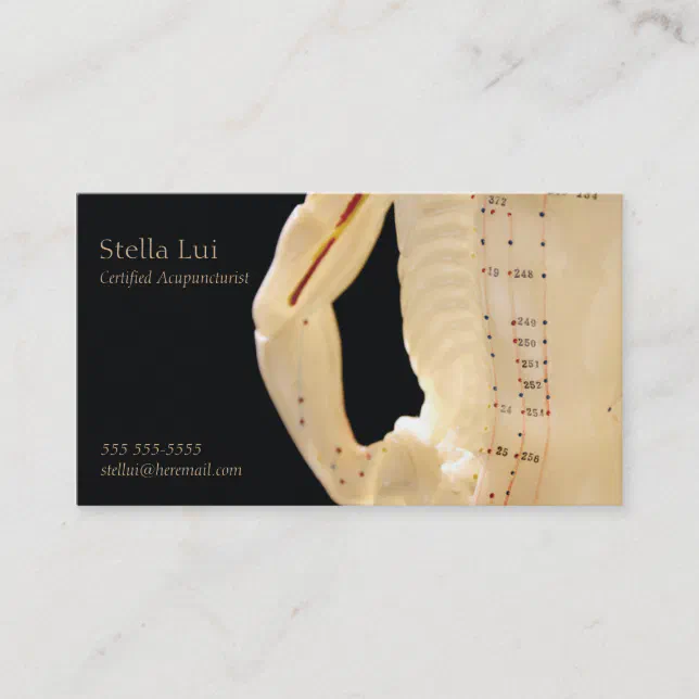 Acupuncture back business card | Zazzle