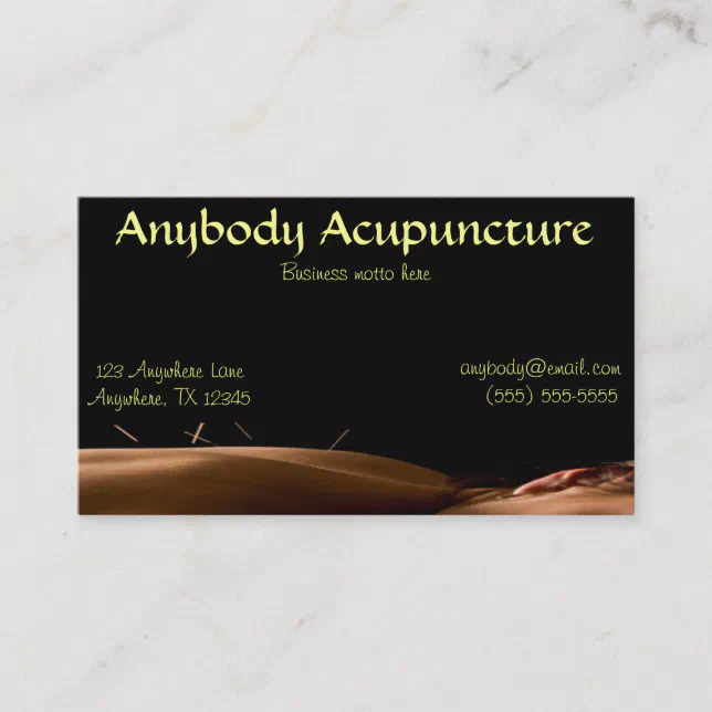 Acupuncture Business Card | Zazzle