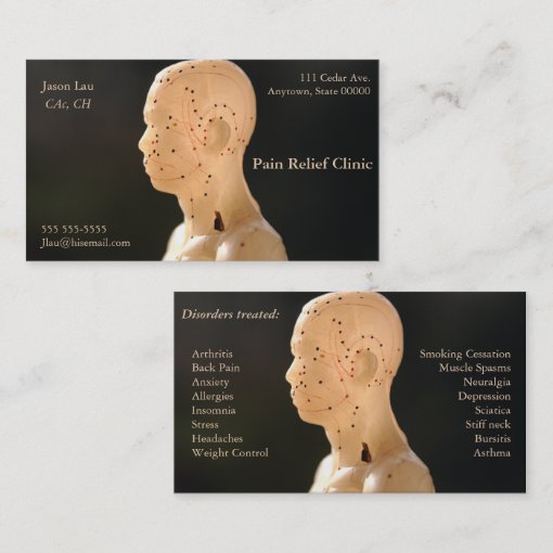 Acupuncture profile business card | Zazzle
