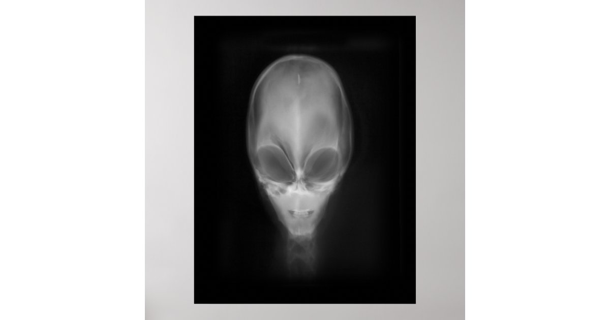 Alien Skull X-ray Poster | Zazzle