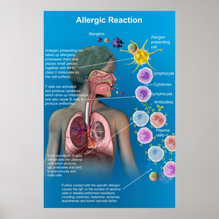 Allergic Reaction poster | Zazzle