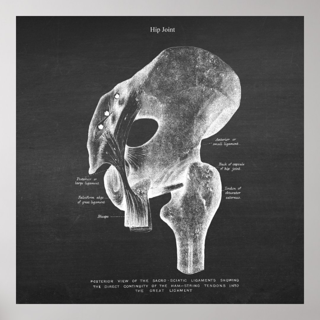 Anatomy Art no. 4 Hip Joint Poster | Zazzle