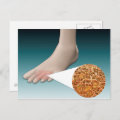 Anatomy Of Foot Fungus With Microscopic Close-Up Postcard | Zazzle