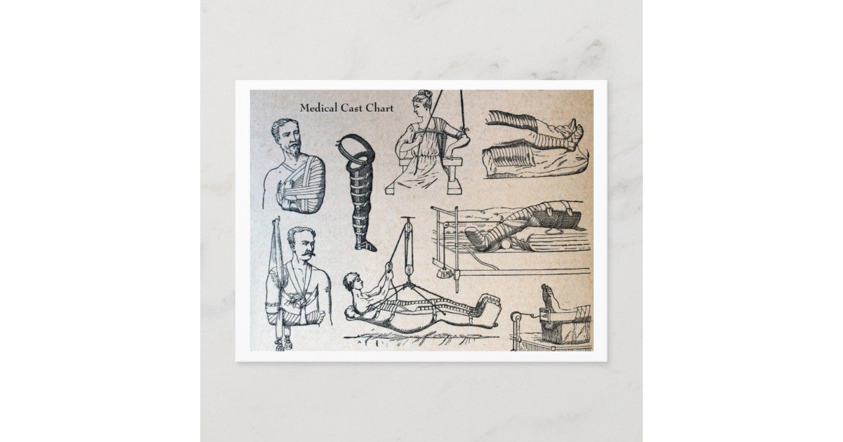 Antique Medical Casts Chart Postcard | Zazzle