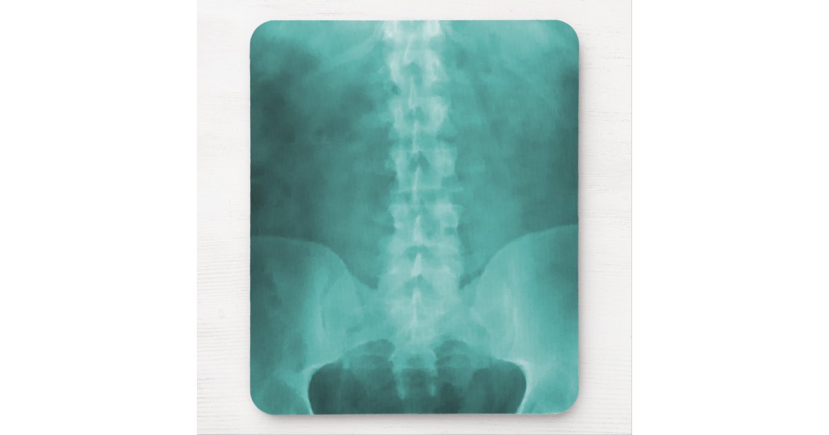 Aqua Digital X-Ray Art Mousepad | Zazzle