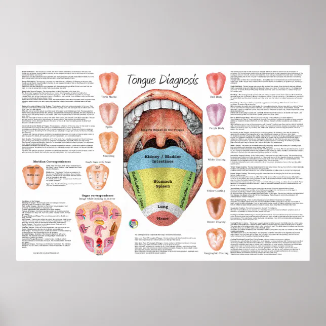 Ayurvedic Tongue Diagnosis Map Poster | Zazzle