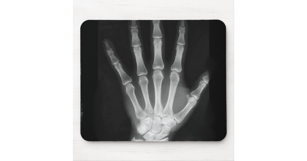 B&W X-ray Skeleton Hand Mouse Pad | Zazzle