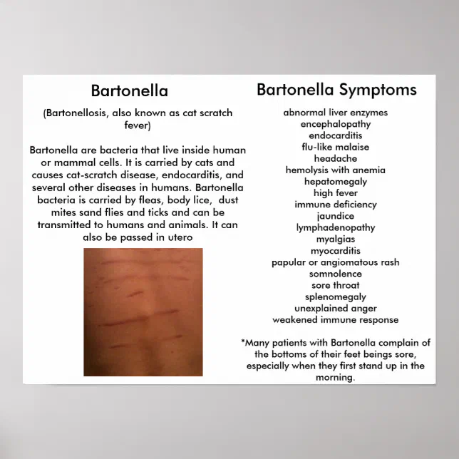Bartonella Symptoms Educational Poster | Zazzle