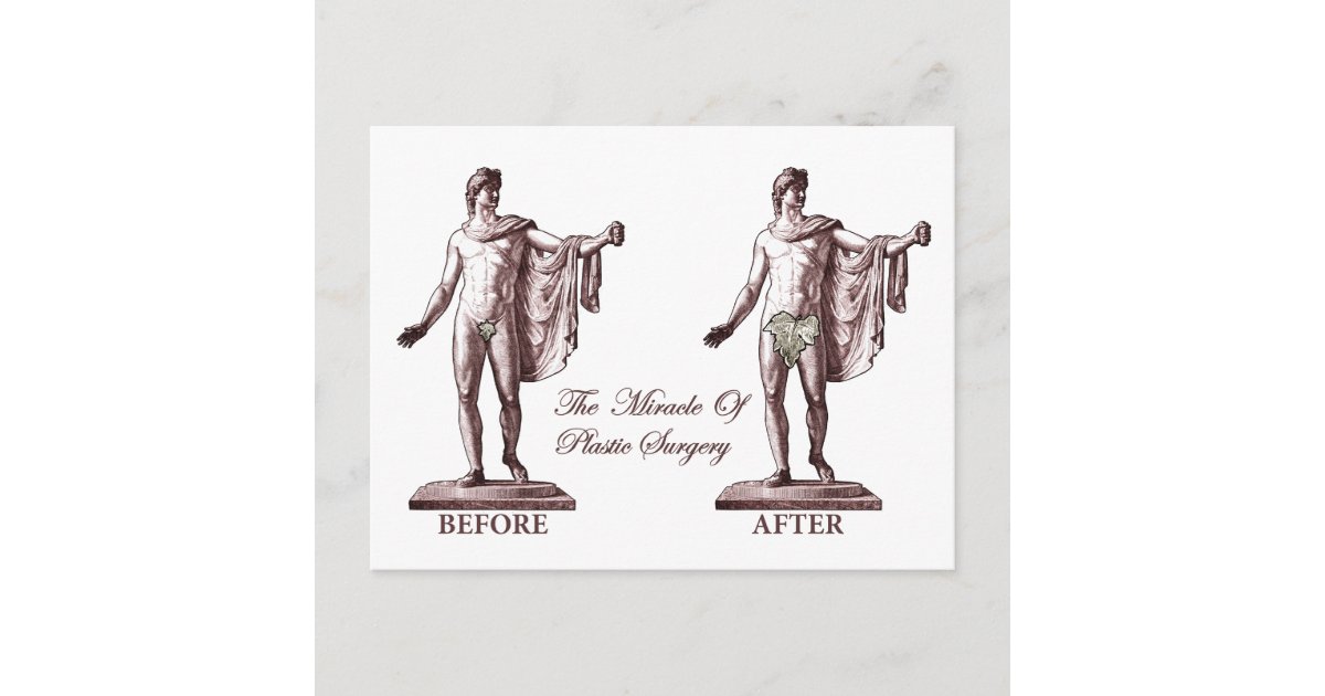 Before and After Postcard | Zazzle