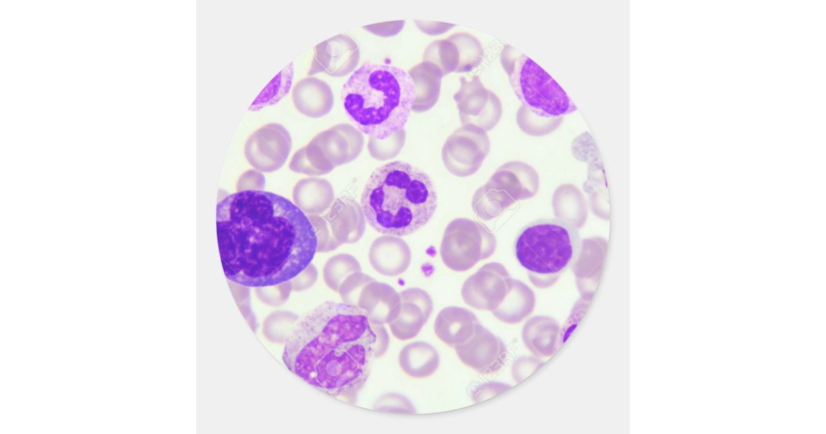 blood smear sticker | Zazzle