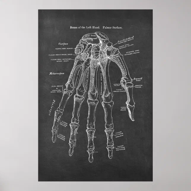 Bones of the Left-Hand Palmar Surface Anatomy Poster | Zazzle