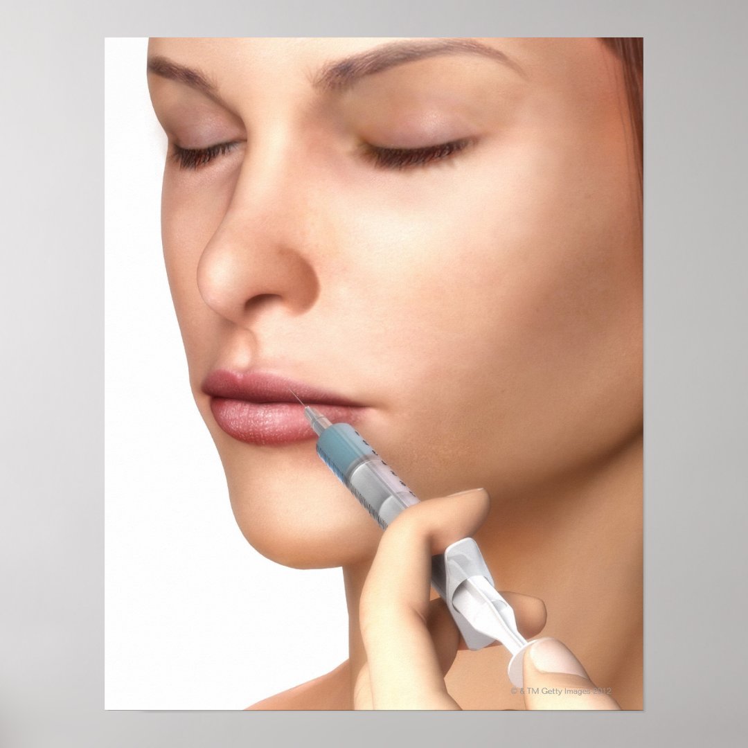 Botox Injections Poster | Zazzle