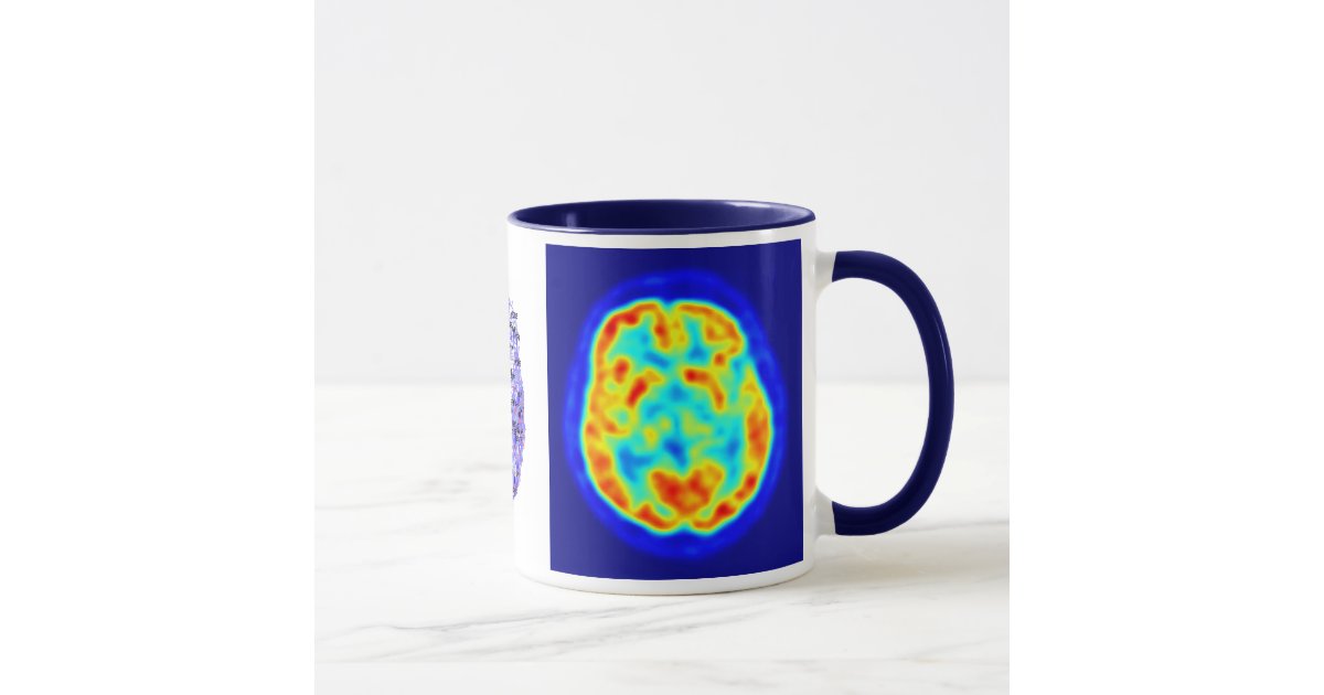 Brain image mug | Zazzle