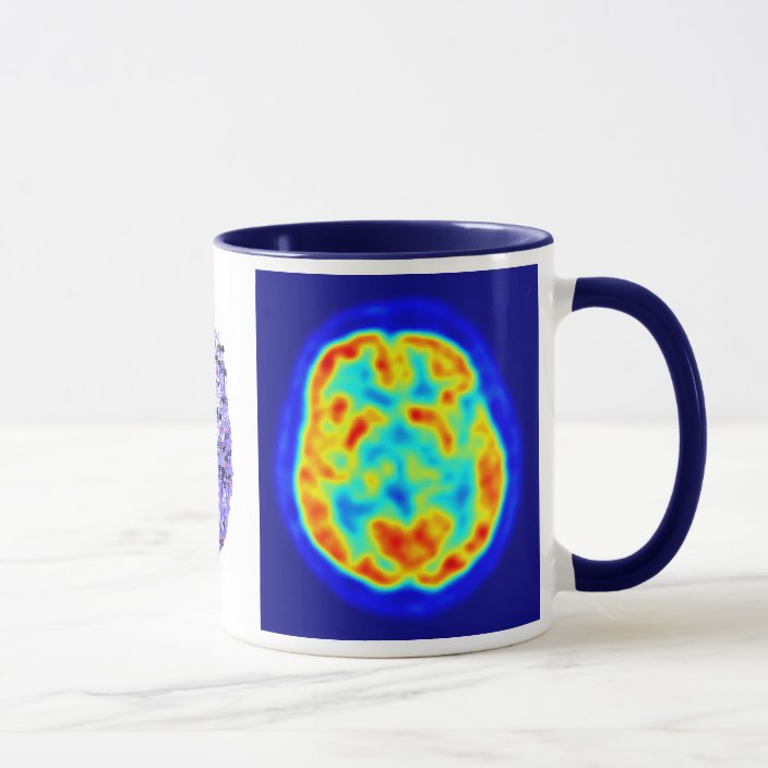 Brain image mug | Zazzle.com