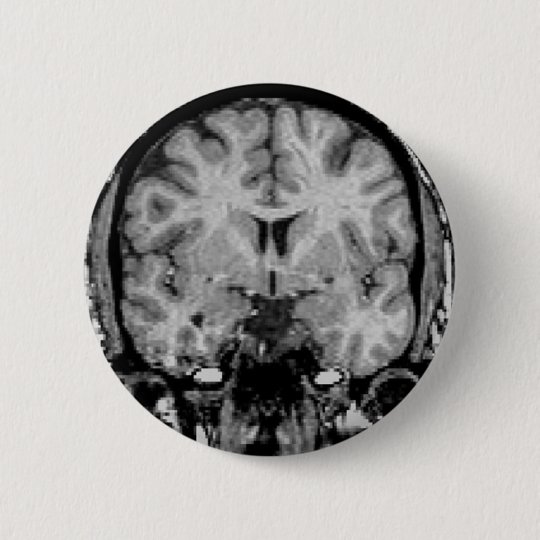Brain MRI, coronal slice Pinback Button | Zazzle.com