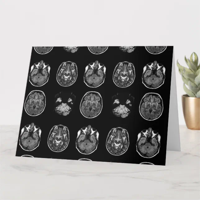 Brain MRI scan Card | Zazzle