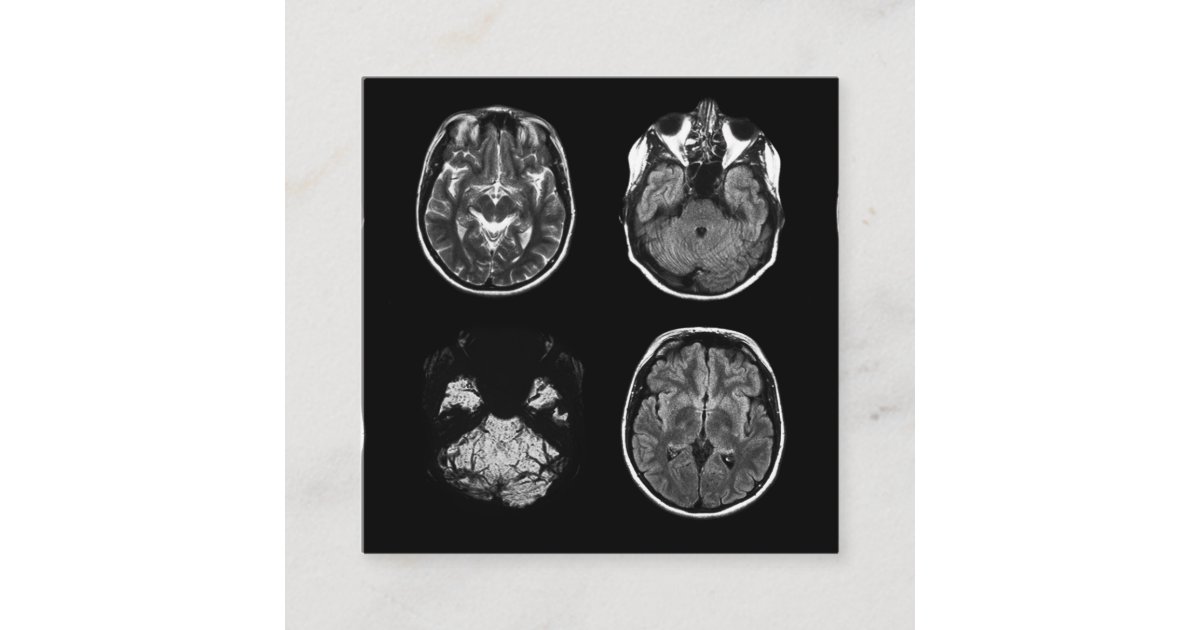 Brain MRI scan Enclosure Card | Zazzle