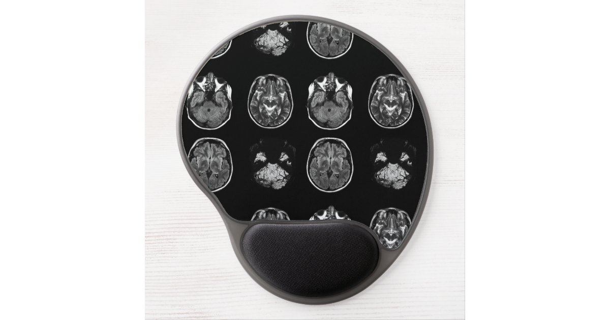 Brain MRI scan Gel Mouse Pad | Zazzle