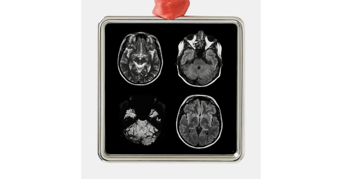 Brain MRI scan Metal Ornament | Zazzle