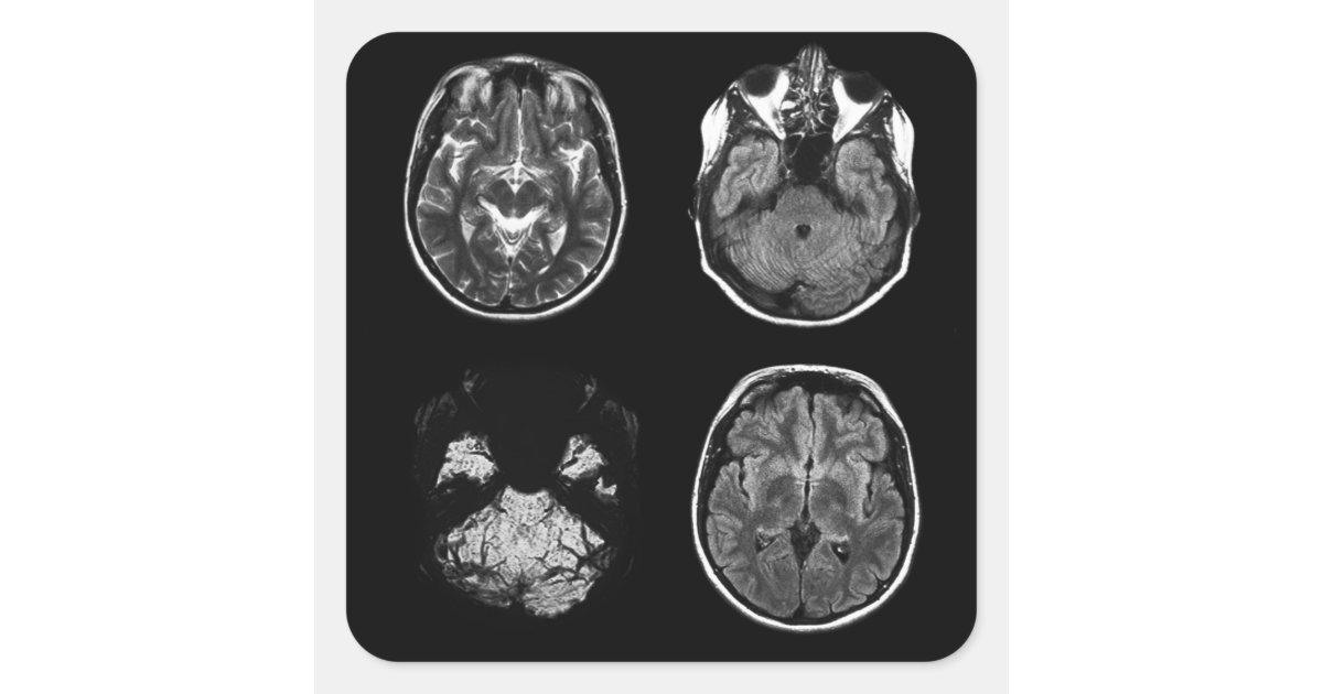 Brain MRI scan Square Sticker | Zazzle