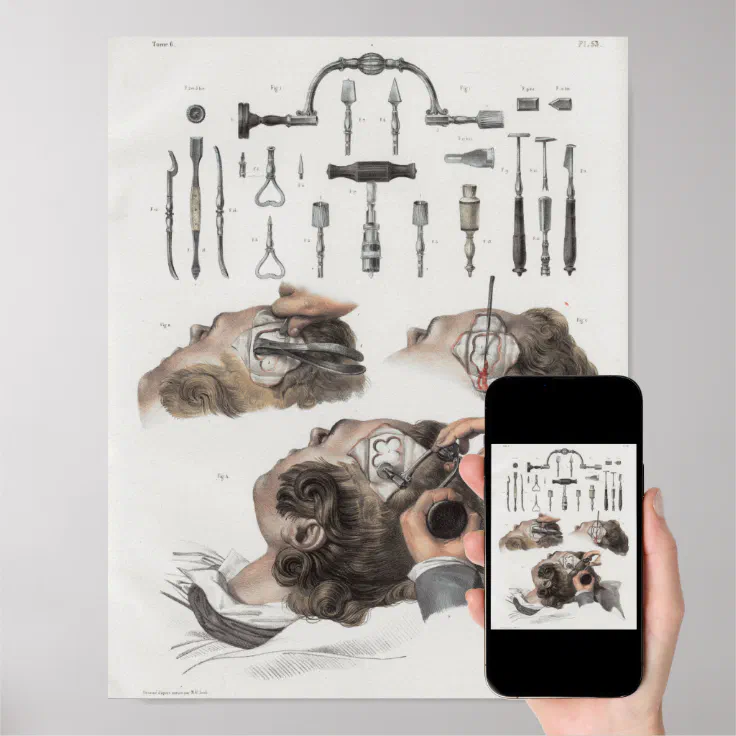 Brain Surgery Instruments Vintage Anatomy Print | Zazzle