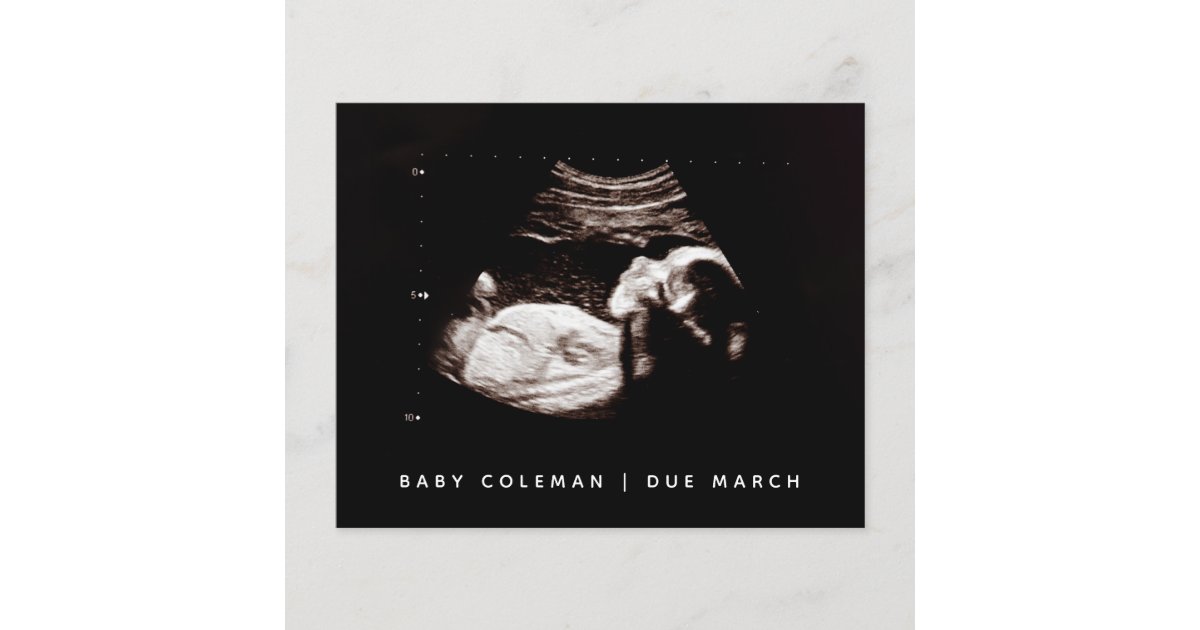 Budget Pregnancy Baby Sonogram Ultrasound Photo Flyer | Zazzle