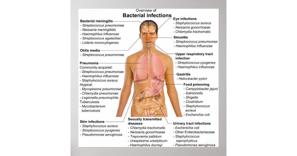 Chart of the Main Bacterial Infections in Humans | Zazzle