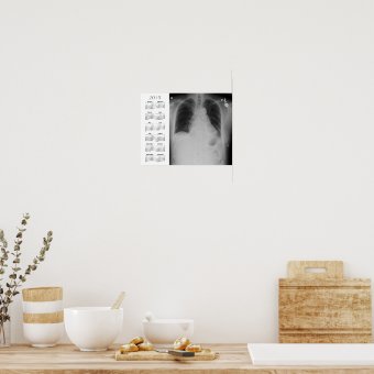 Chest X Ray calendar ~ Poster | Zazzle