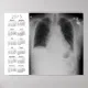 Chest X Ray calendar ~ Poster | Zazzle