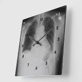 Chest X Ray ~ Clock | Zazzle