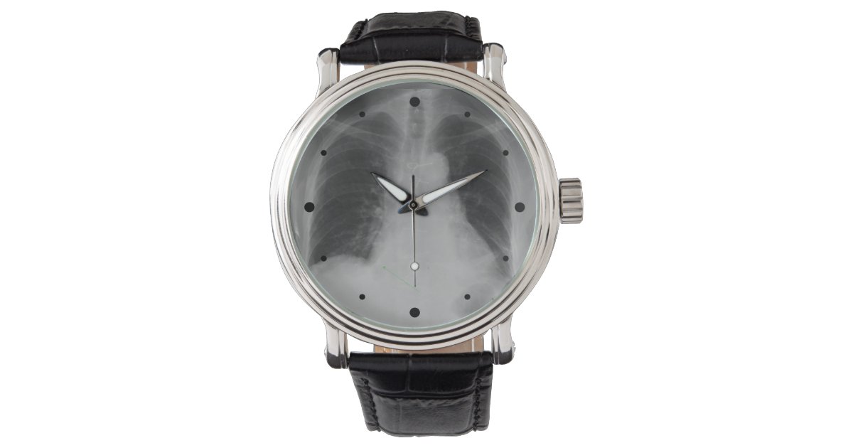 Chest X Ray ~ watch | Zazzle