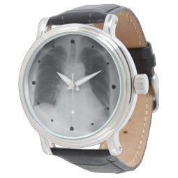 Chest X Ray ~ watch | Zazzle