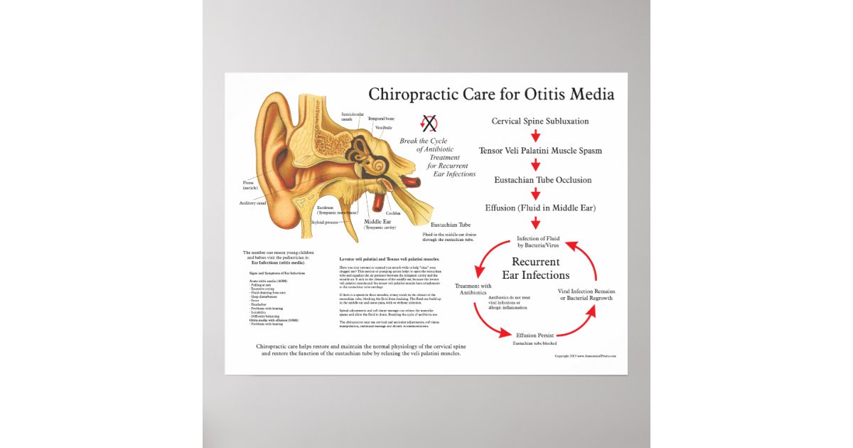 otitis media poster