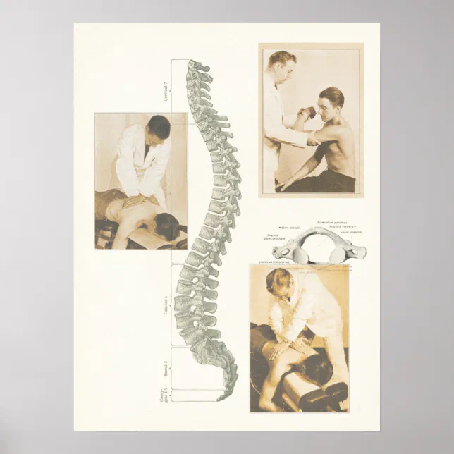Chiropractic Spinal Adjustment Poster | Zazzle