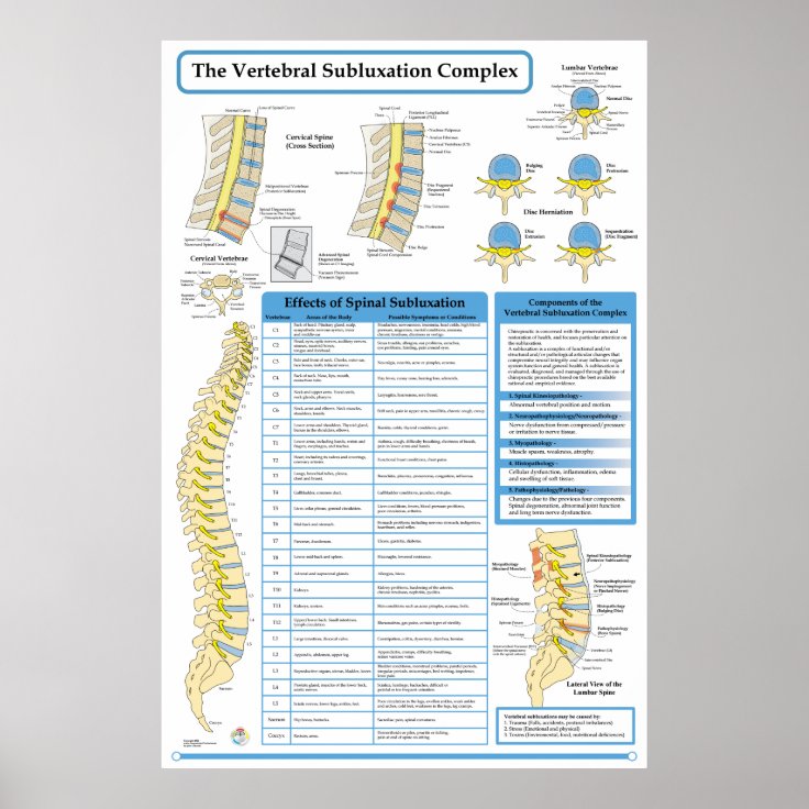 Chiropractic Vertebral Subluxation Complex Poster | Zazzle