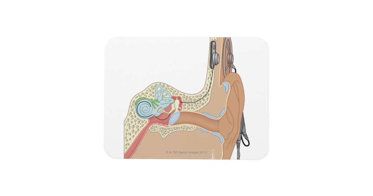 Cochlear Implants Magnet | Zazzle