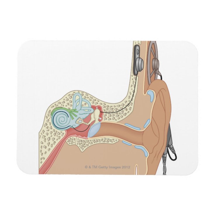 Cochlear Implants Magnet | Zazzle