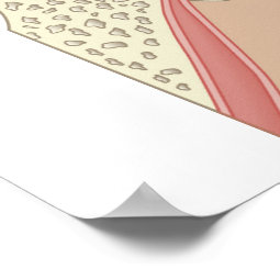 Cochlear Implants Poster | Zazzle