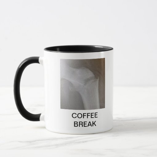 COFFEE BREAK MUG | Zazzle