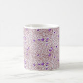 Coffee Mug - Chronic Myeloid Leukemia (CML) | Zazzle