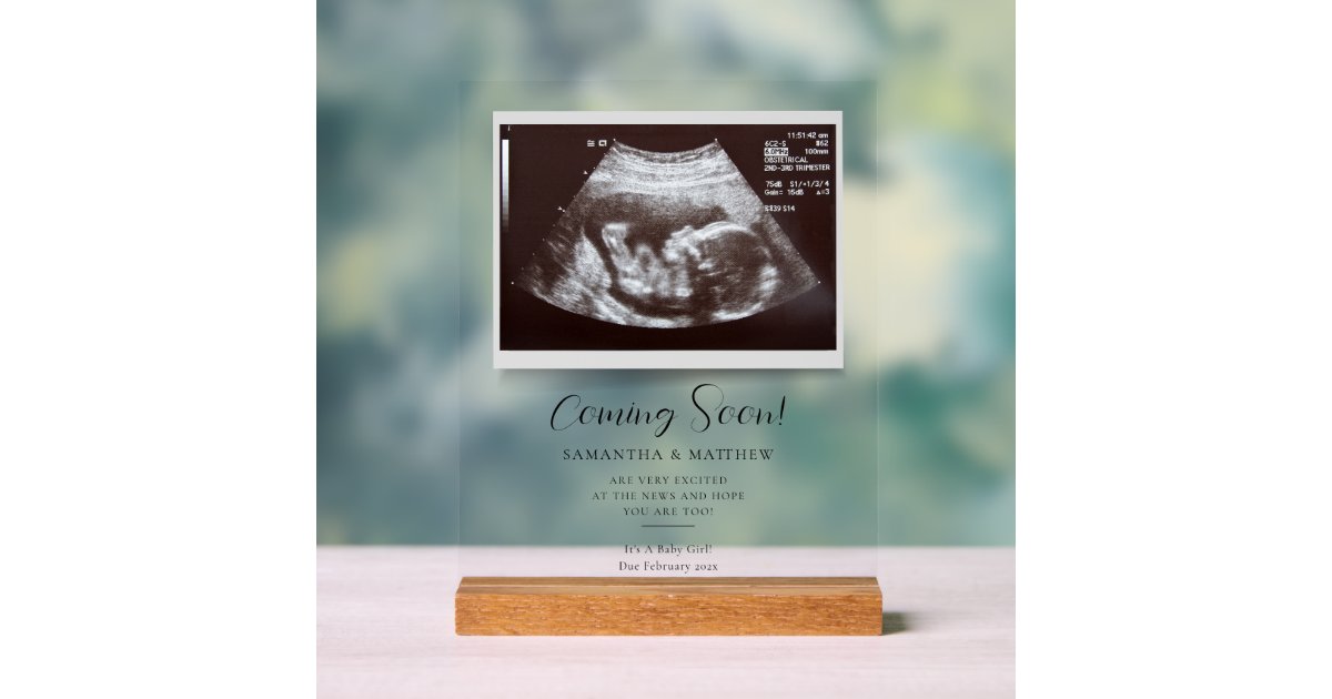 Coming Soon Sonogram Pregnancy Announcement Acrylic Sign | Zazzle