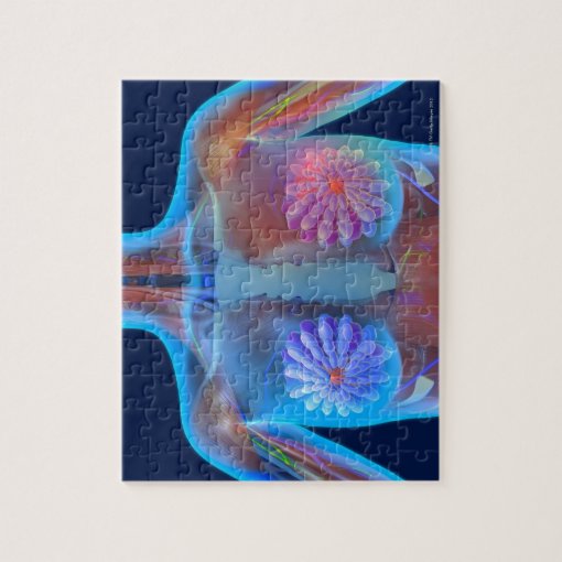 Computer artwork representing breast cancer, jigsaw puzzle | Zazzle