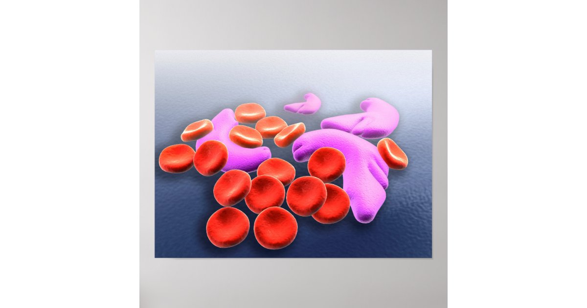 Conceptual Image Of Sickle Cell Anemia Poster | Zazzle