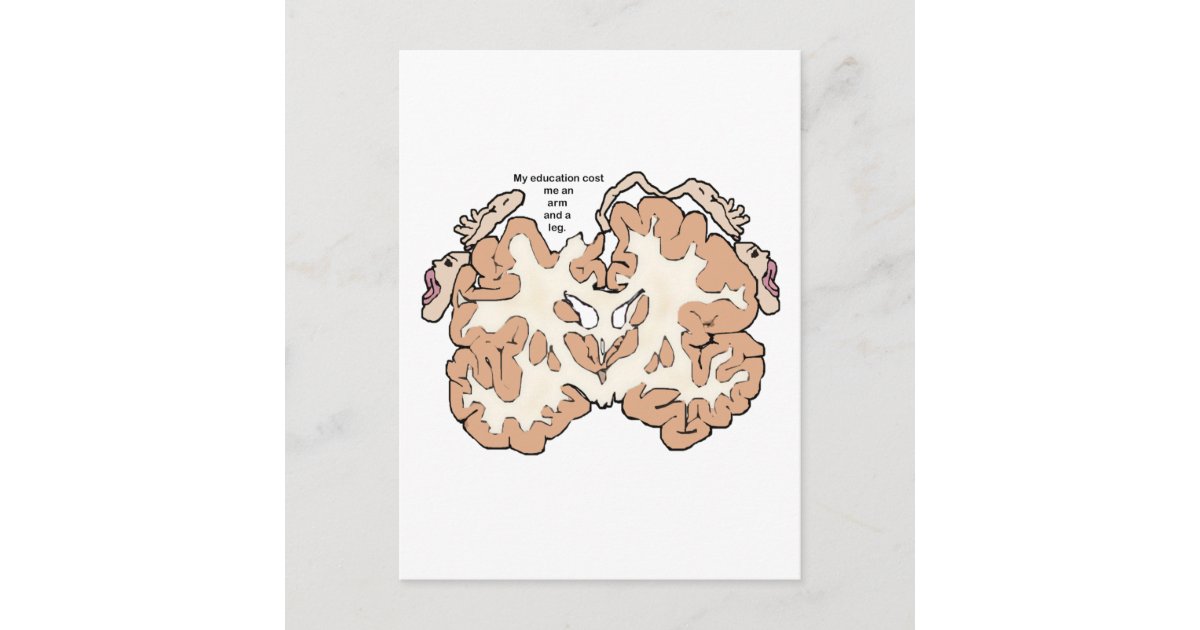 Cost an arm and a leg homunculus postcard | Zazzle